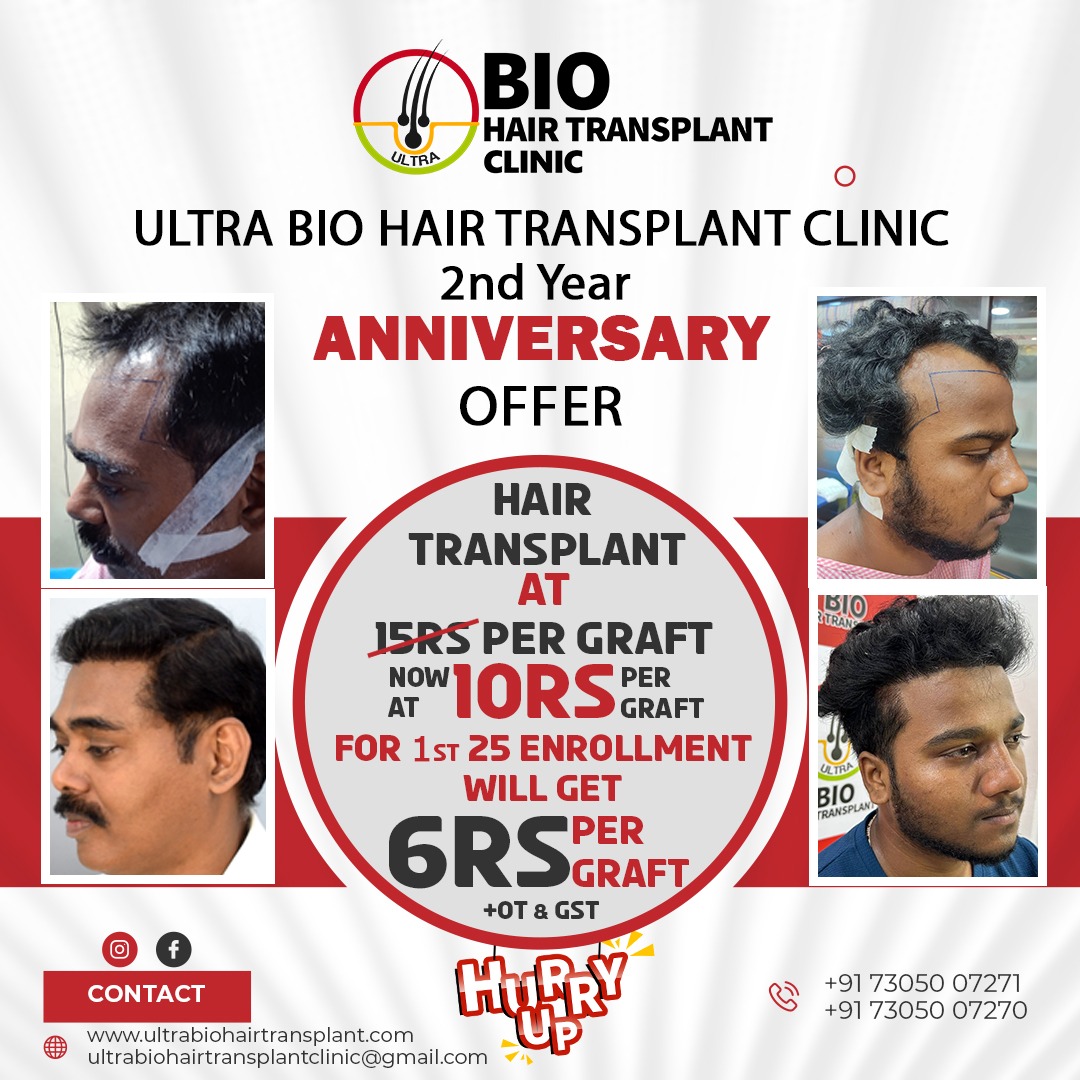 ULTRA BIO HAIR TRANSPLANT CLINIC