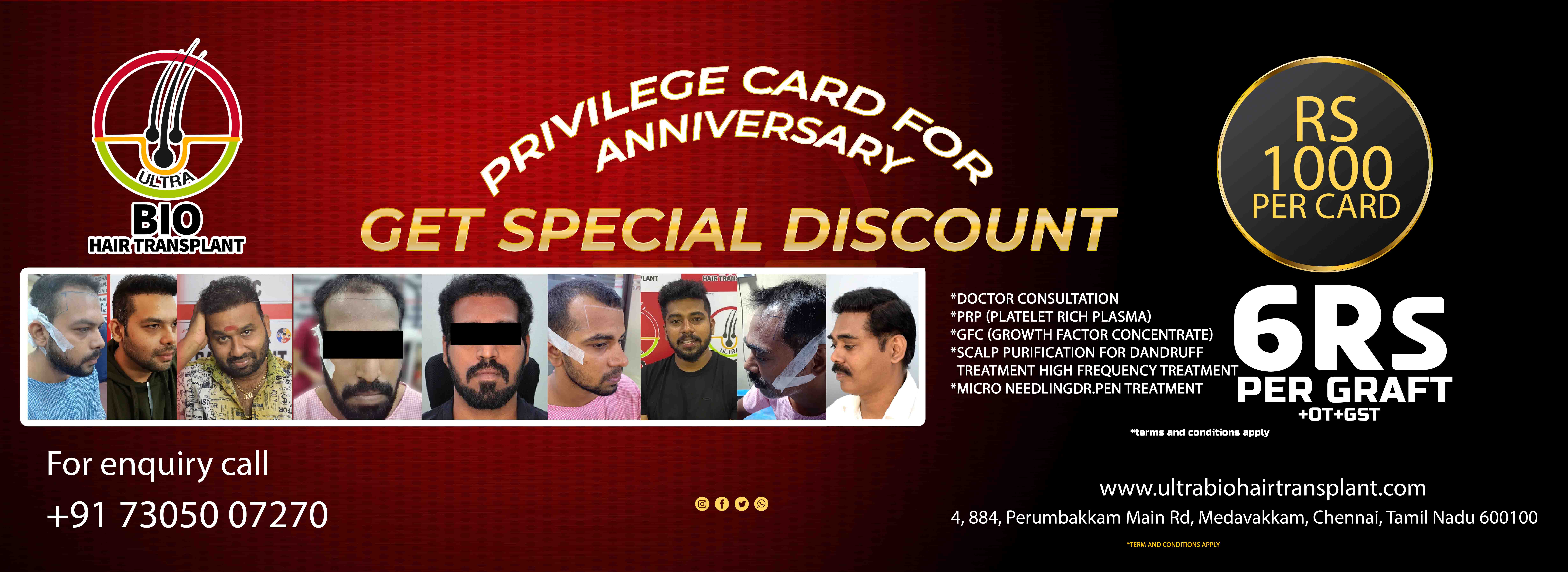 Ultra Bio Hair Transplant Clinic Chennai